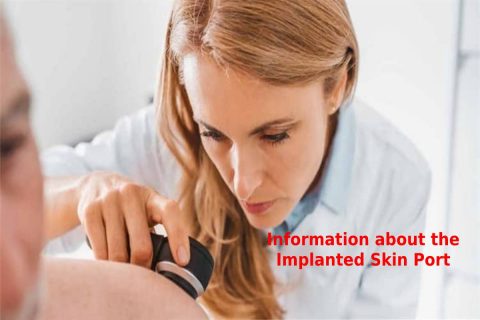 How does Second Skin Tattoo Work? – Advantages and Disadvantages